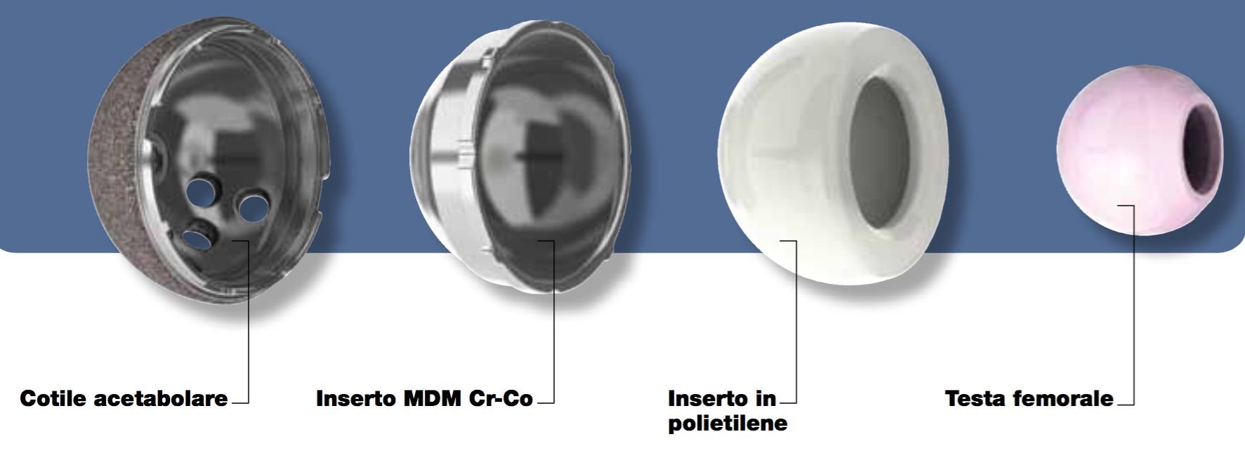 Nuovi impianti protesici | La Tribologia – La protesi d'anca mini ...